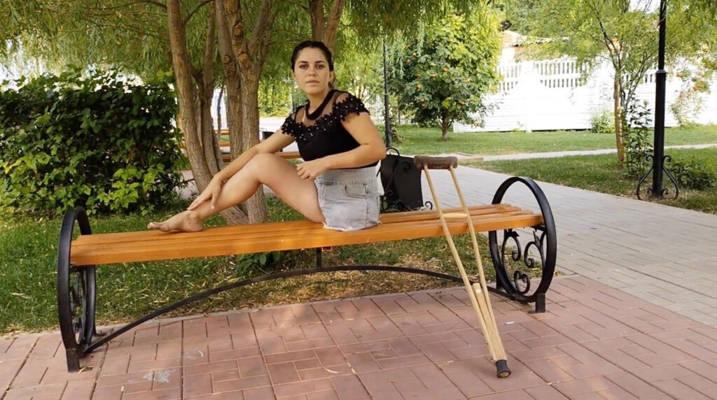 Diyabetik Ayakta Ampütasyon Ne Zaman Gerekir ve nasıl önlenir? - Sağlık ...